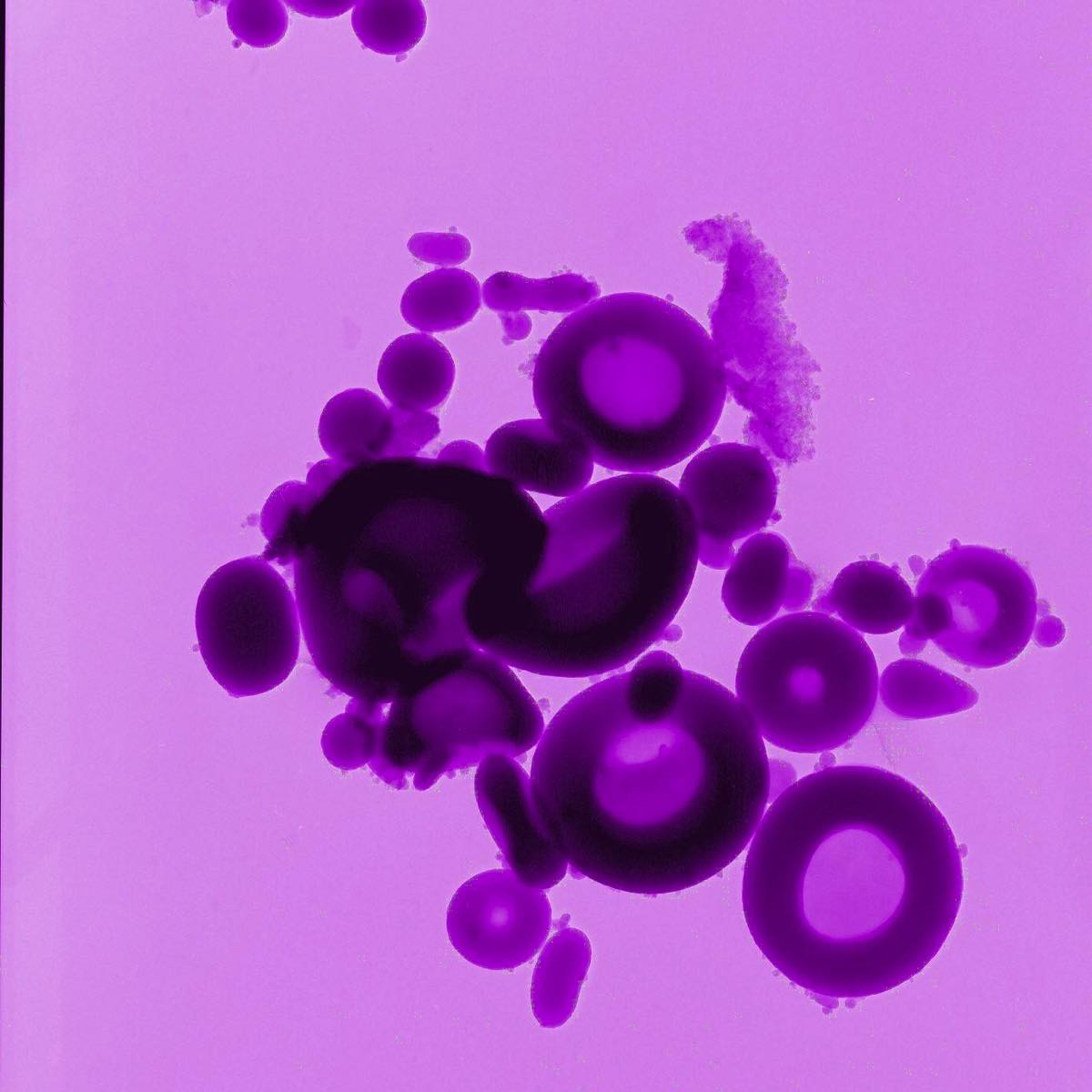 Microscopía Electrónica de Transmisión